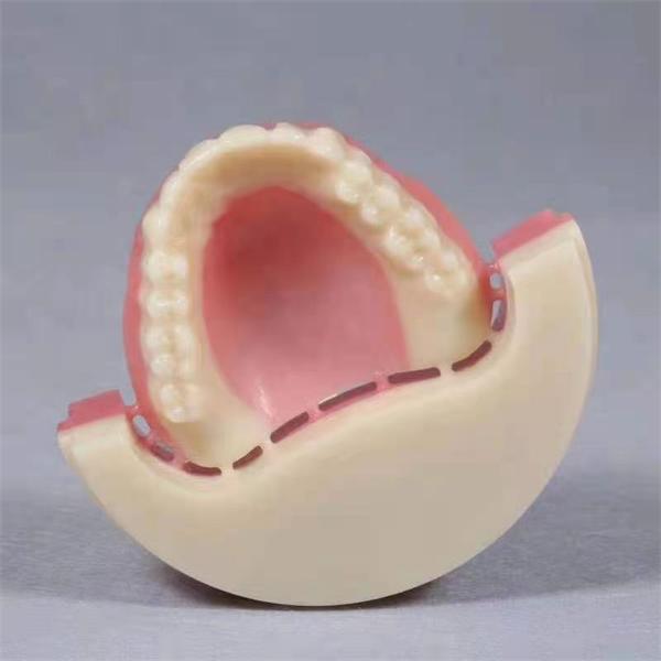 Removable dental PMMA disc - dengman