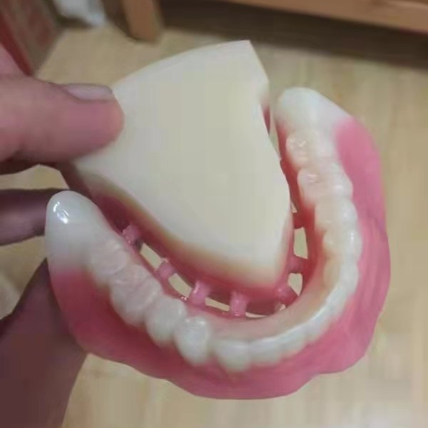 Removable dental PMMA disc - dengman